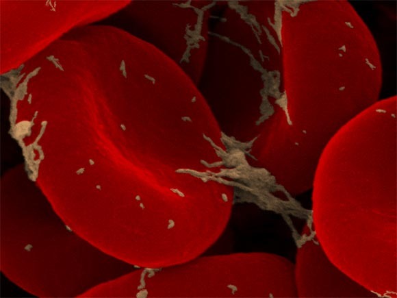 Human Physiology – Hematology and Characteristics of Blood Cells ...