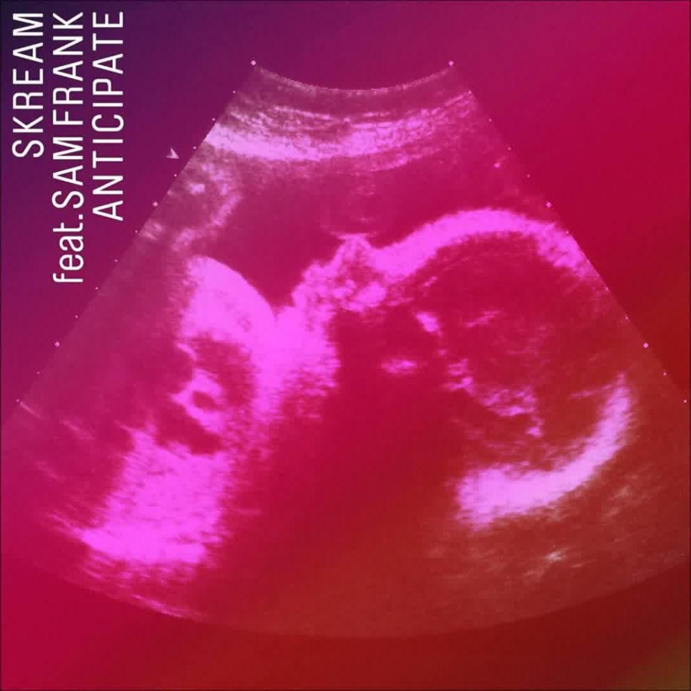 Skream – Anticipate Lyrics | Genius Lyrics